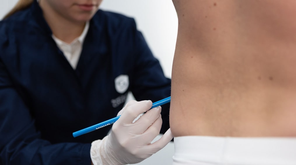 Cooltech Define® | 360° Body Contouring - Cryolipolysis - Cooltech Define